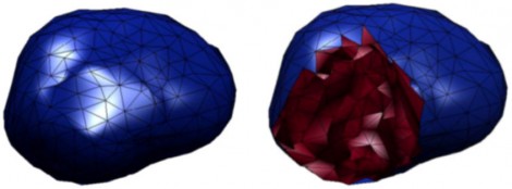 Biomechanical Modeling to Enhance Imaging-Guided Prostate Biopsy ...