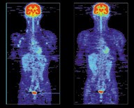 Hamamatsu to Manufacture and Market Most of Zecotek's Imaging ...