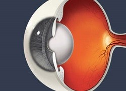 Lensar Lasers for Cataract Surgery Use Adimec Machine Vision Cameras ...