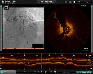 Light Technologies Offer a View into the Body - Novus Light Today