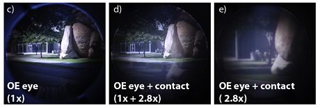 Telescopic Contact Lenses for Macular Degeneration Patients - Novus ...