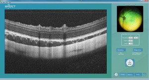 Wasatch Photonics Launches WP OCT Software Platform - Novus Light Today