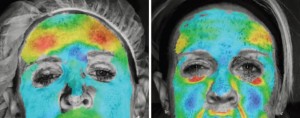 3D Imaging Technique for Precision Injectable Wrinkle Reducers - Novus ...